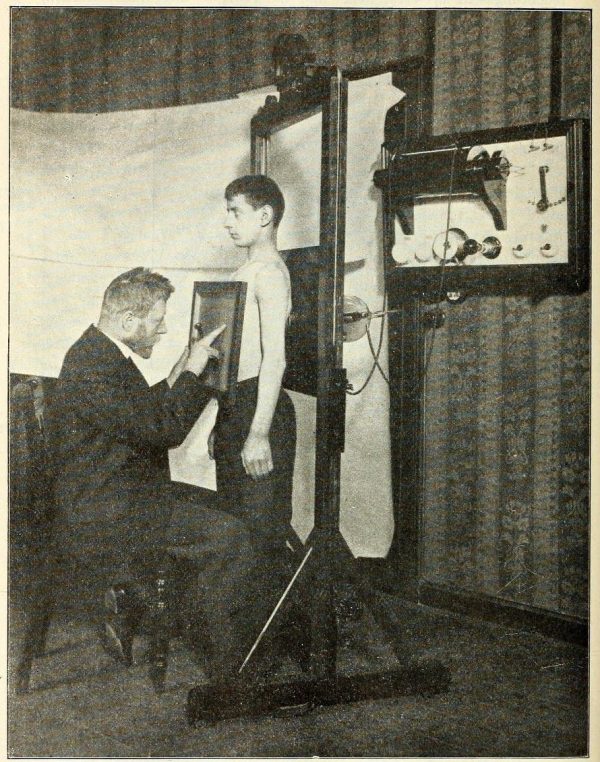 How X-rays were discovered in the 1890s - momentous Victorian medical ...