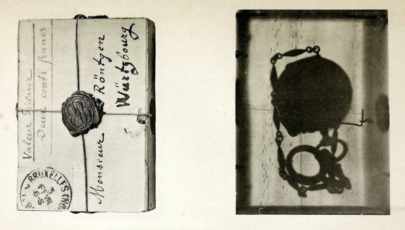 How X-rays were discovered in the 1890s - momentous Victorian medical ...