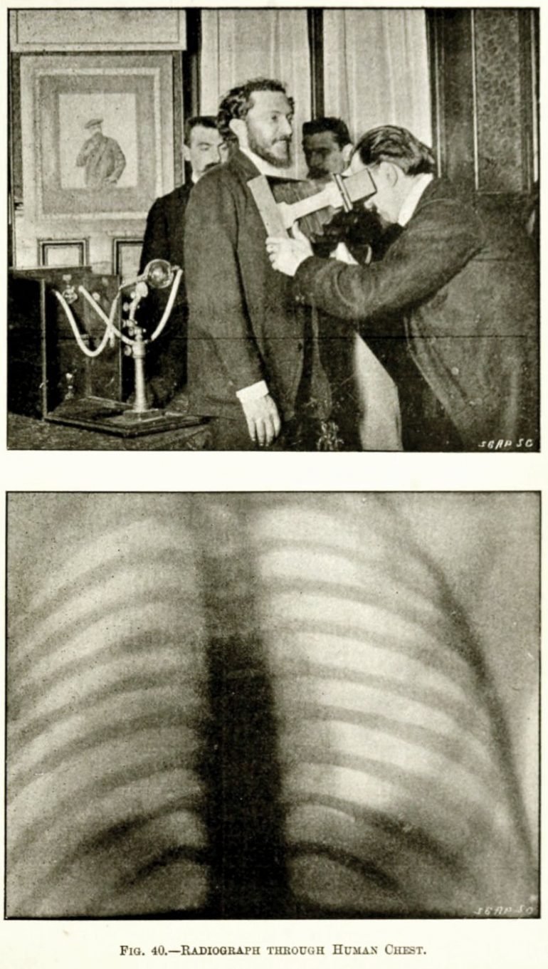 How X-rays were discovered in the 1890s - momentous Victorian medical ...