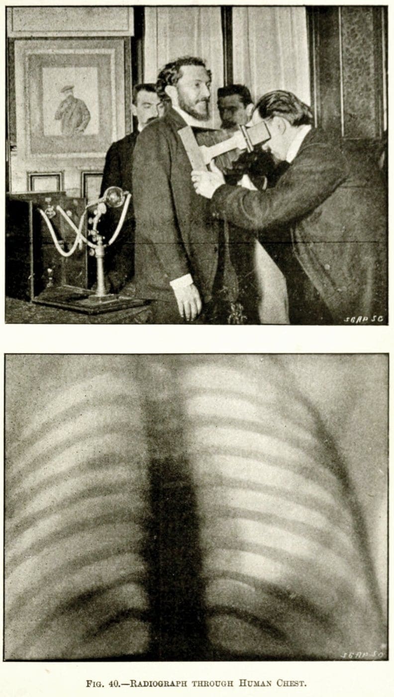 How X-rays were discovered in the 1890s - momentous Victorian medical ...