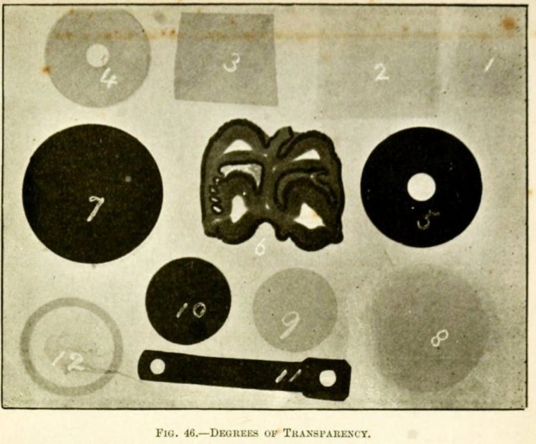 How X-rays were discovered in the 1890s - momentous Victorian medical ...