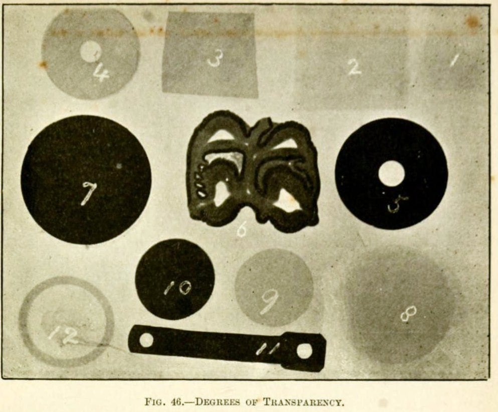 How X-rays were discovered in the 1890s - momentous Victorian medical ...