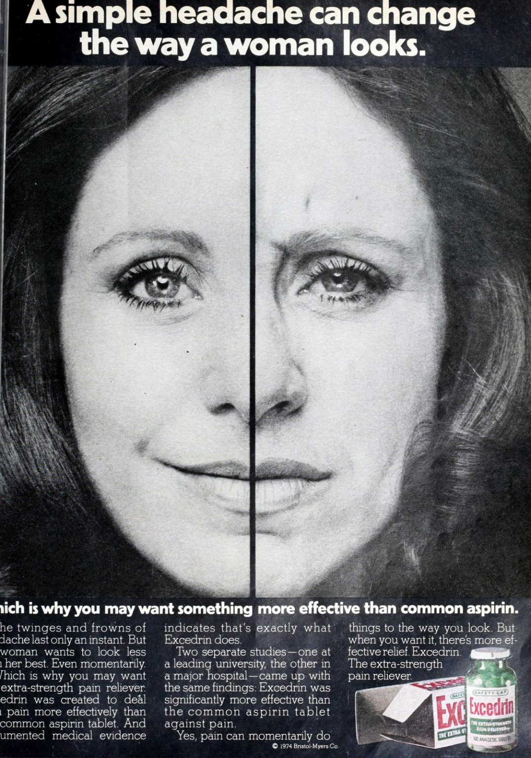 Excedrin: I had a headache THIS big... (1985) - Click Americana