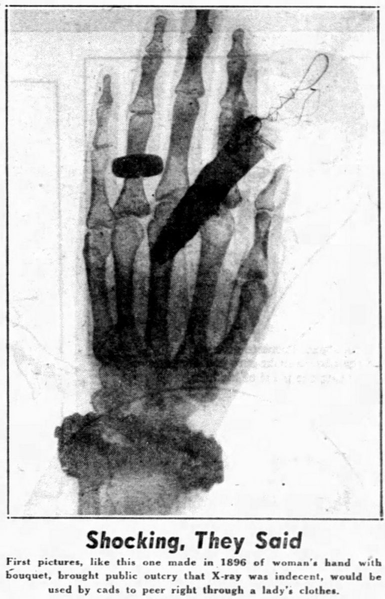 How X-rays were discovered in the 1890s - momentous Victorian medical ...