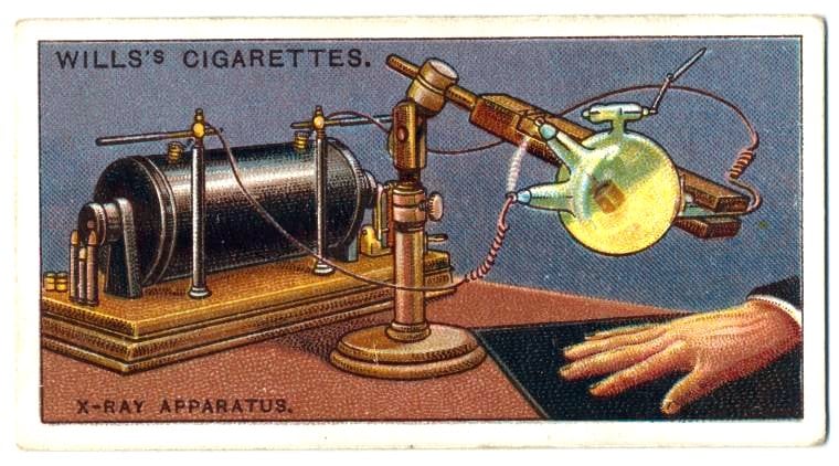 How X-rays were discovered in the 1890s - momentous Victorian medical ...