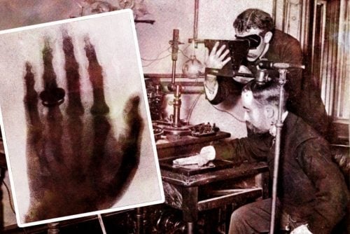 How X-rays were discovered in the 1890s - momentous Victorian medical ...