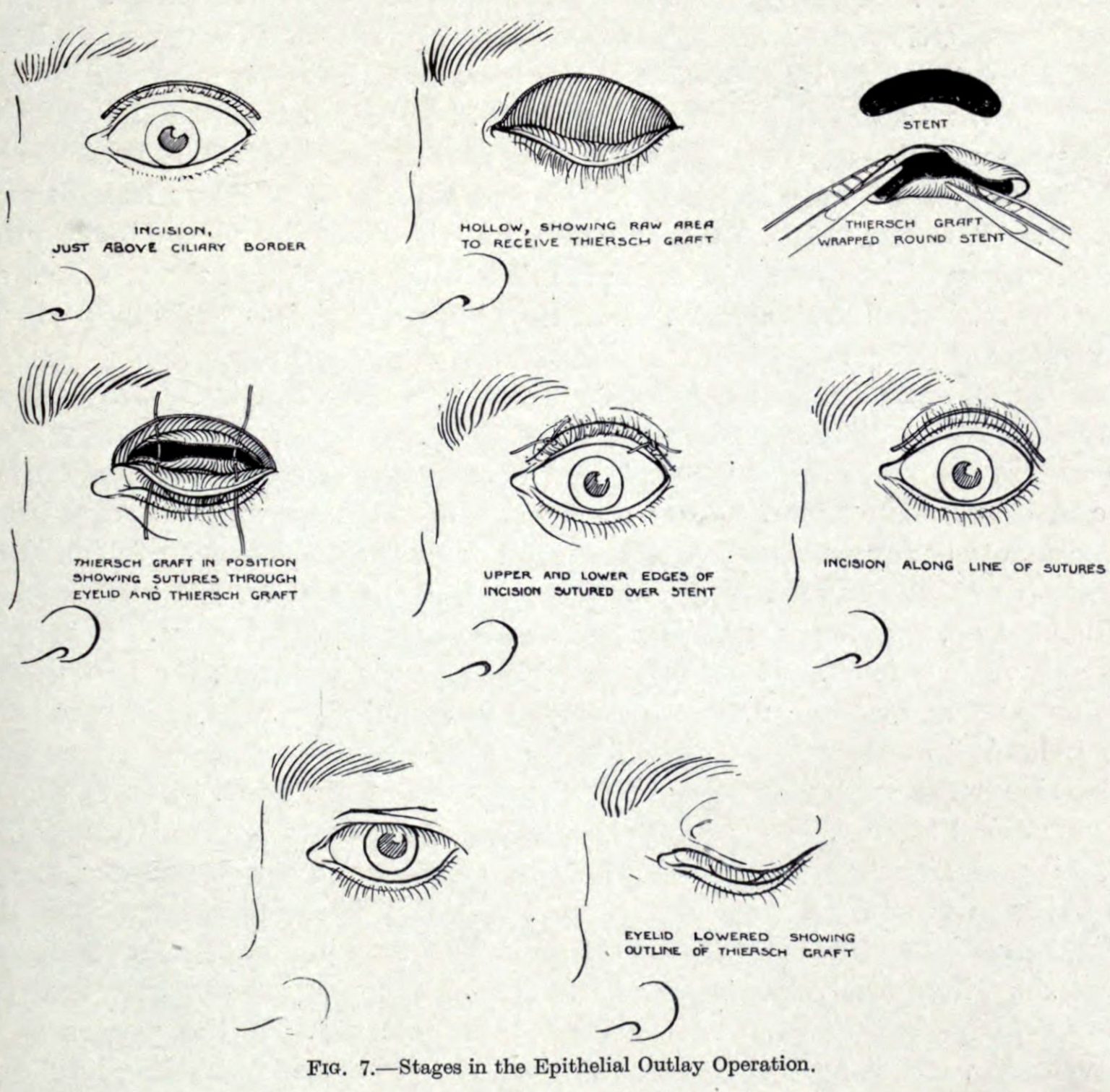 Plastic surgery in the 1920s: How WWI and Hollywood fueled the frenzy ...