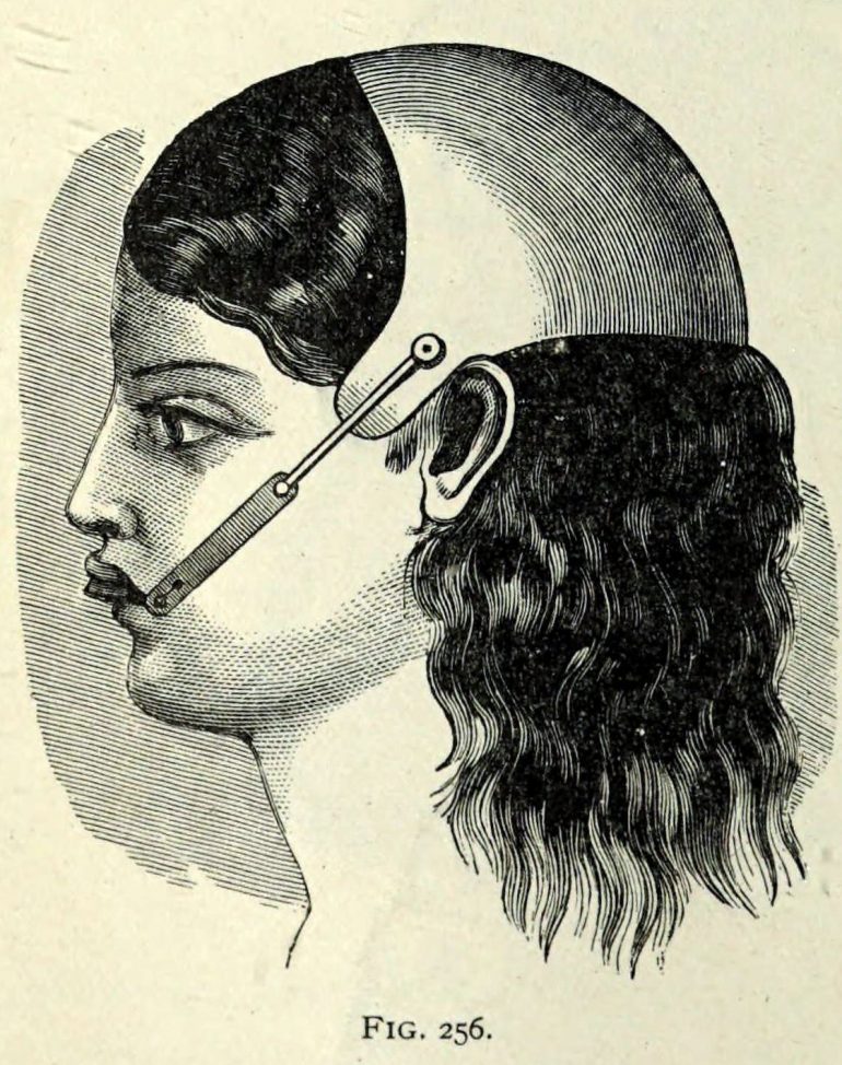 Old-fashioned dentistry makes dental care today seem like magic - Click ...