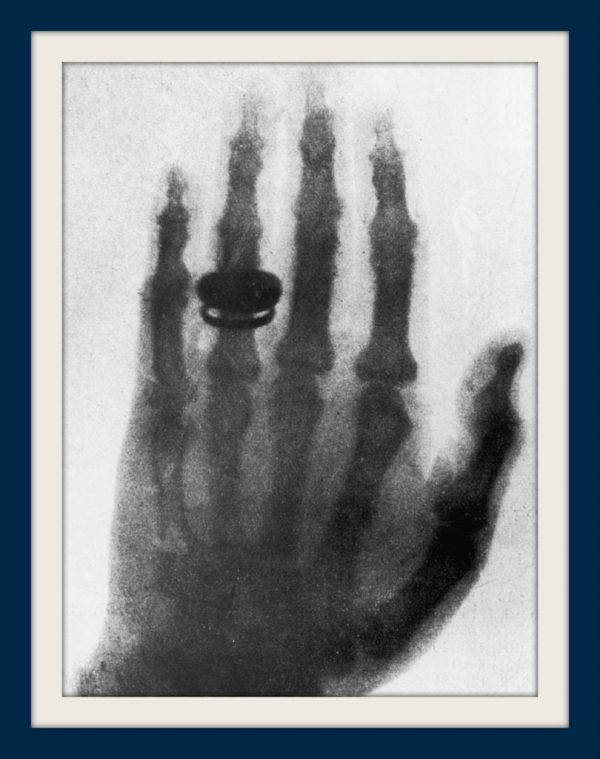 How X-rays were discovered in the 1890s - momentous Victorian medical ...