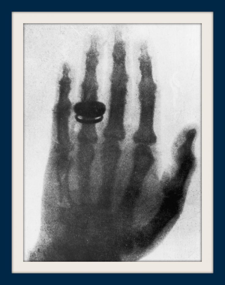 How X-rays were discovered in the 1890s - momentous Victorian medical ...