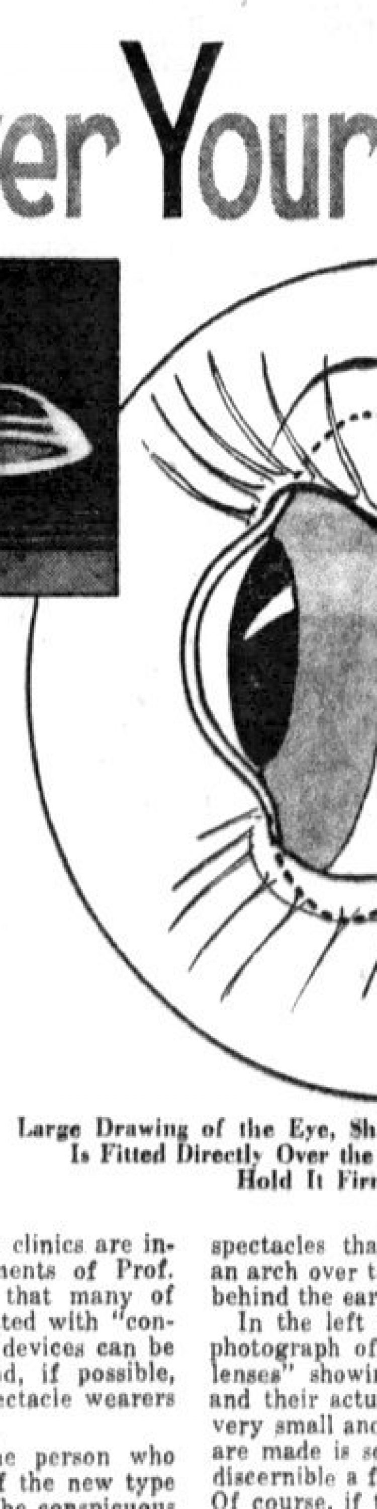 The Invention Of Contact Lenses at Clifford Hochstetler blog