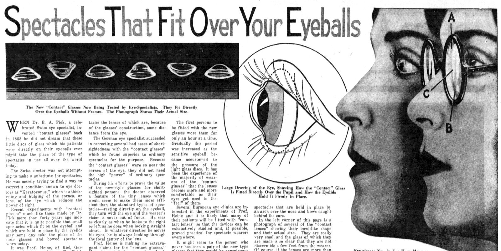 The Invention Of Contact Lenses at Clifford Hochstetler blog