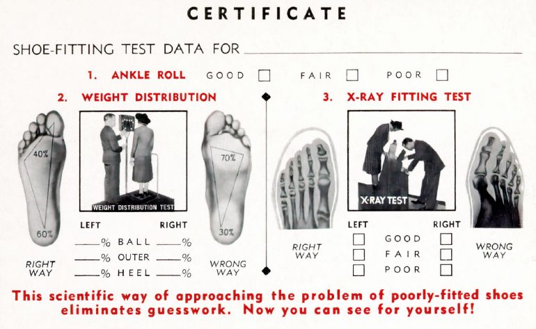 How X-ray shoe fittings used to really be a thing years ago - Click ...