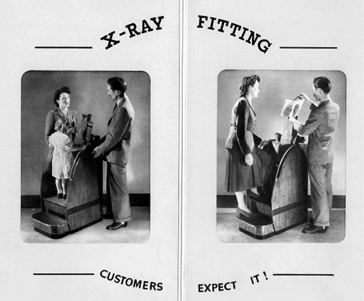 How X-ray shoe fittings used to really be a thing years ago - Click ...